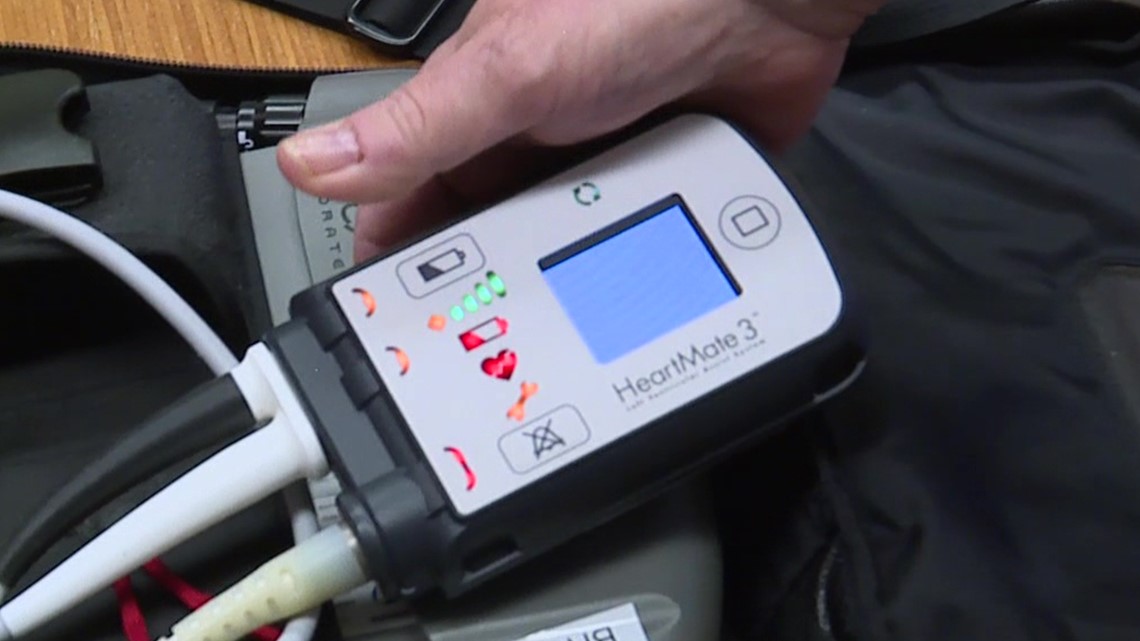 Healthwatch 16: How a device called LVAD could save your life | wnep.com