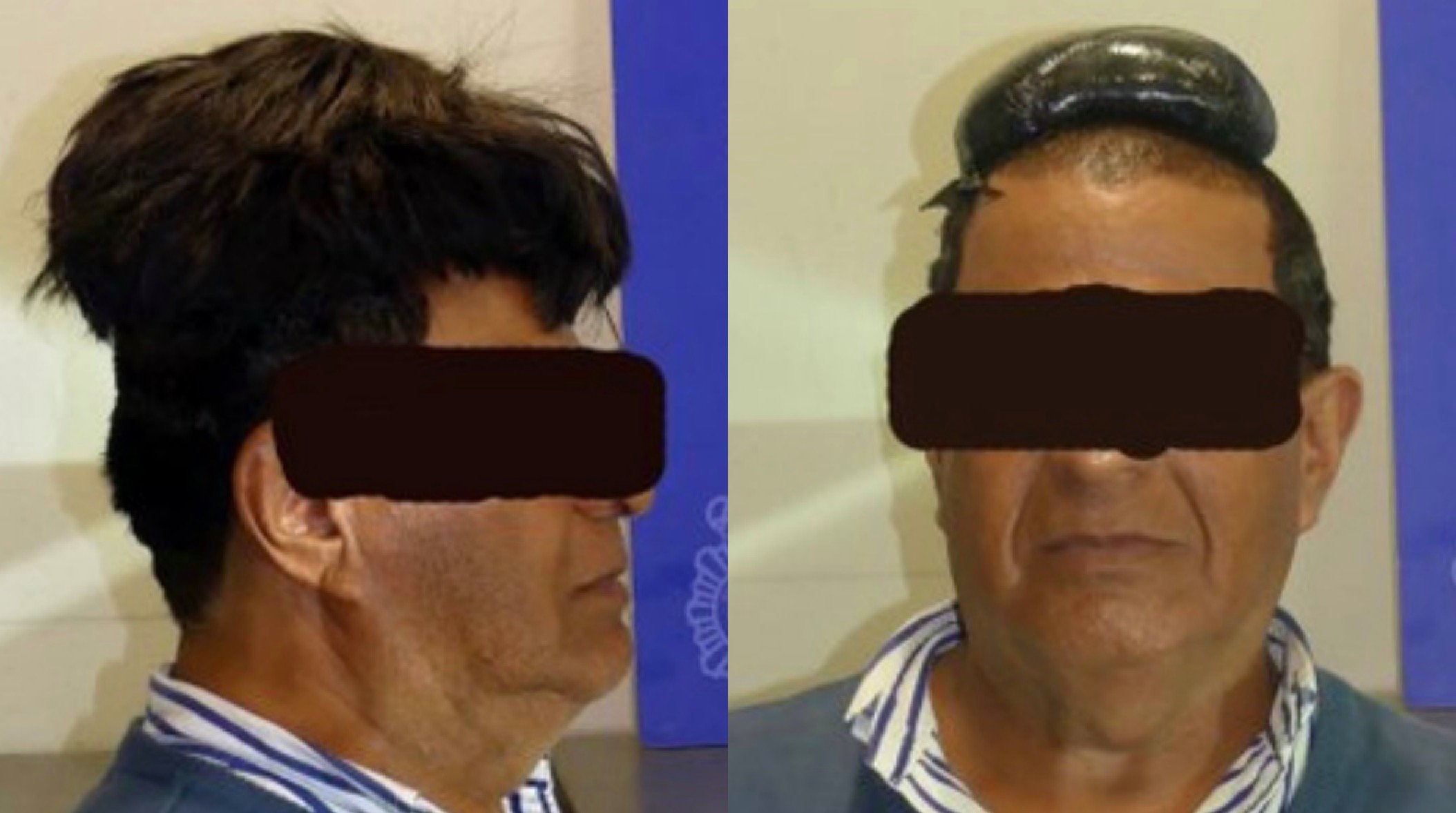 Spanish Police Arrest Cocaine Bigwig With Drugs Hidden Under Ill-Fitting Toupee | wnep.com