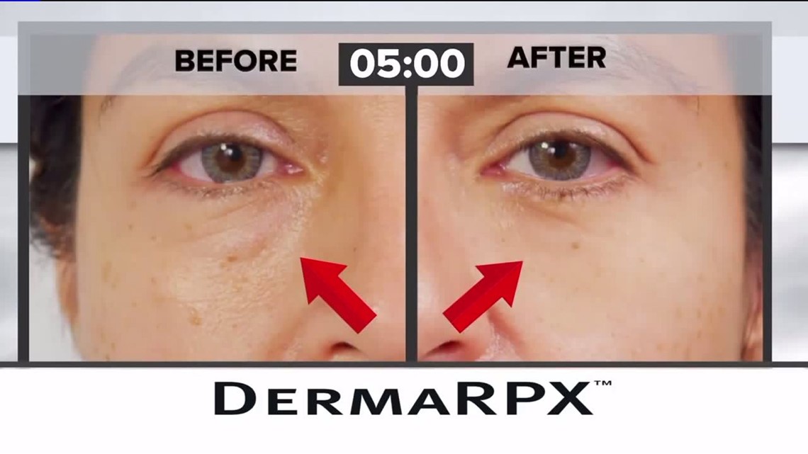 Does It Really Work: Derma RPX | wnep.com