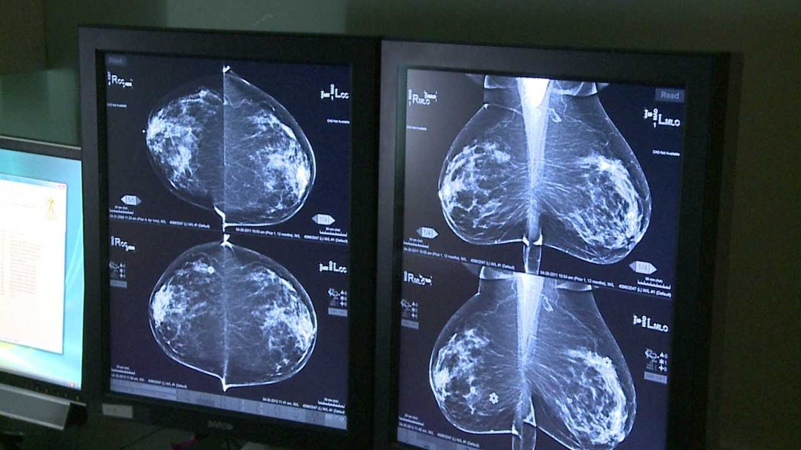 Free Mammogram Screenings in Scranton | wnep.com