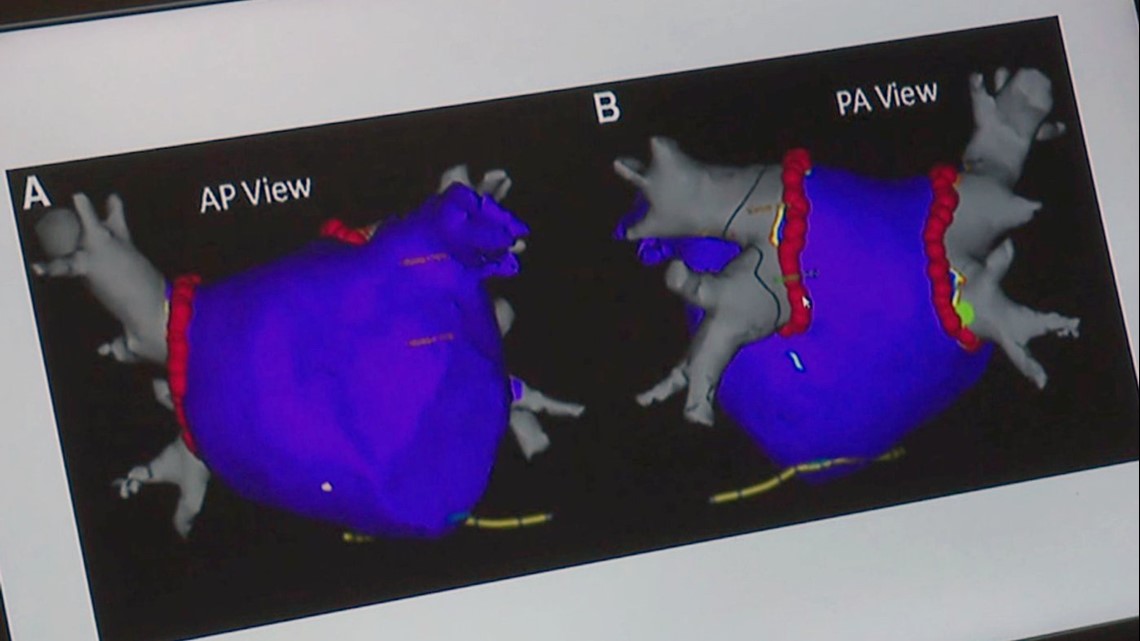 Healthwatch 16: Detecting AFib | wnep.com