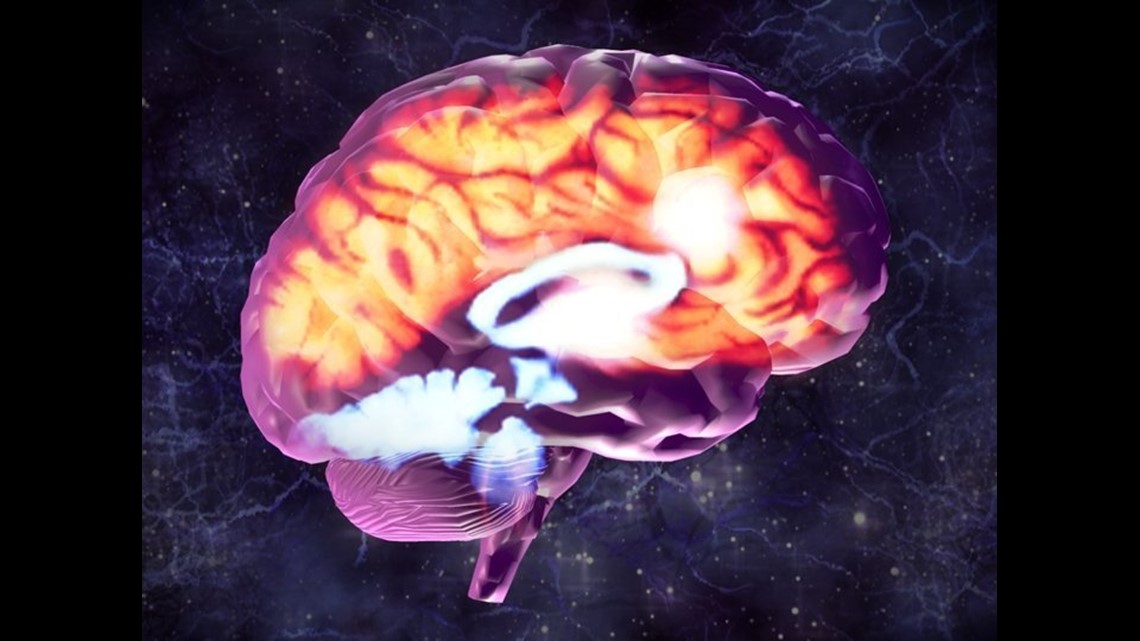 ‘Concussion’ Drawing Head Injury Attention | wnep.com