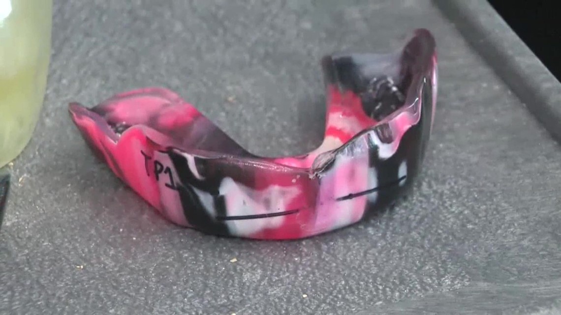 Healthwatch 16: Experts explain how to keep your teeth safe | wnep.com