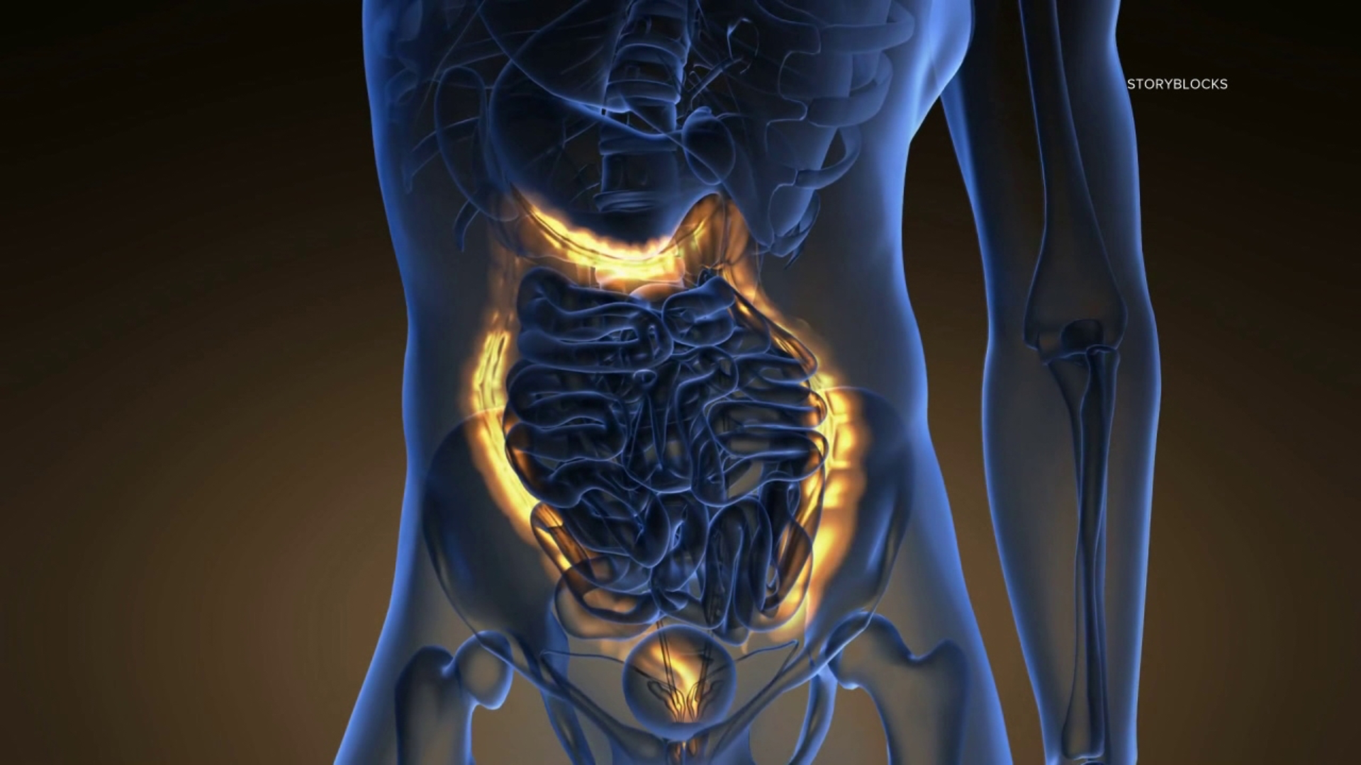 Recognizing the signs of colon cancer | Healthwatch 16 | wnep.com