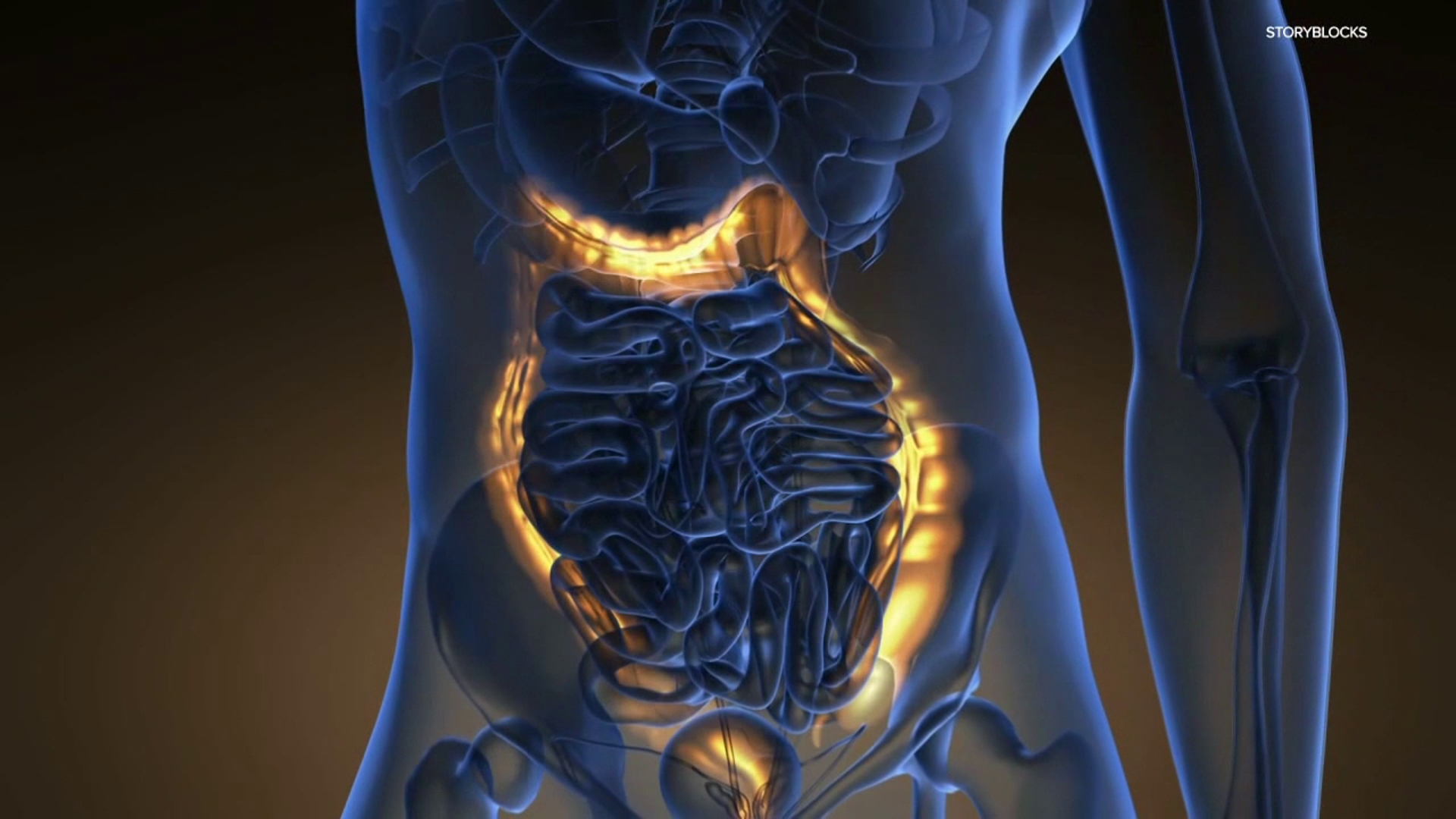 Healthwatch 16 | Colon and rectal conditions | wnep.com