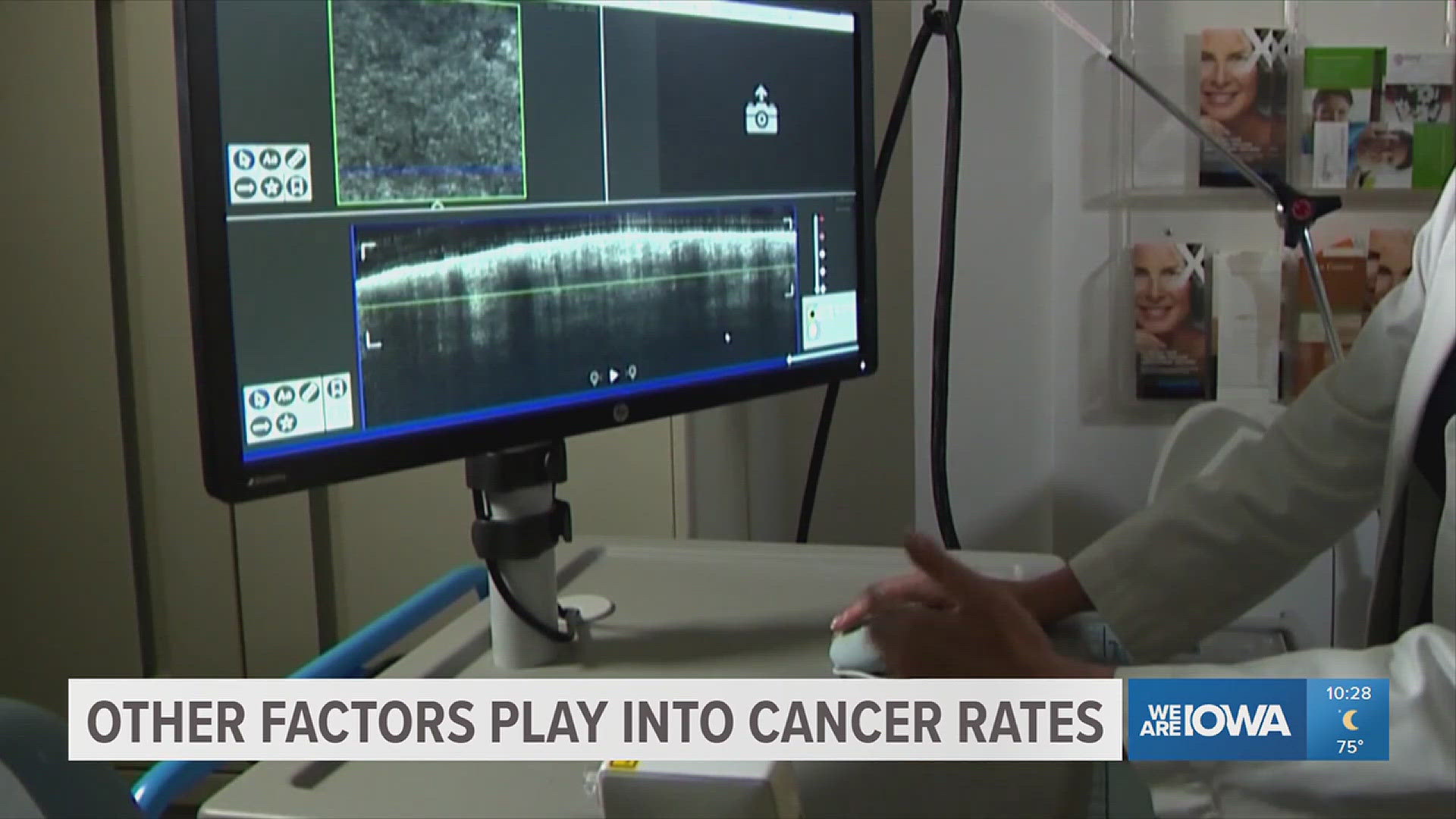 What's behind Iowa's high cancer rates? | weareiowa.com