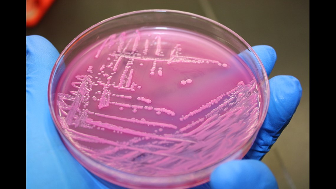 Swimming advisory issued for popular lake due to E. coli contamination ...