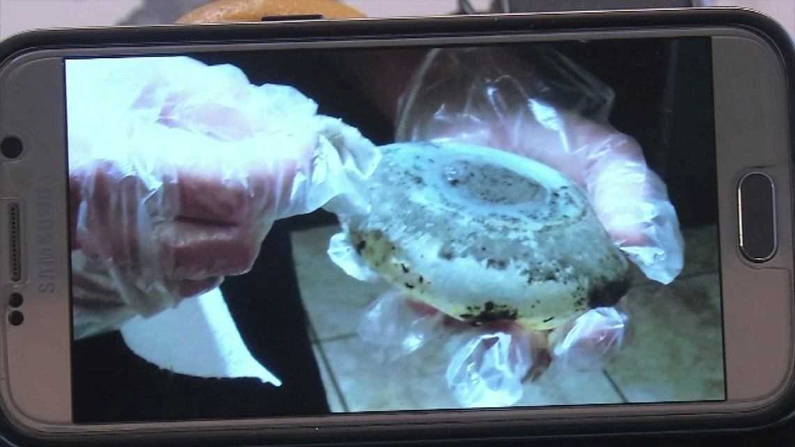 Woman says breast implants grew mold | fox43.com