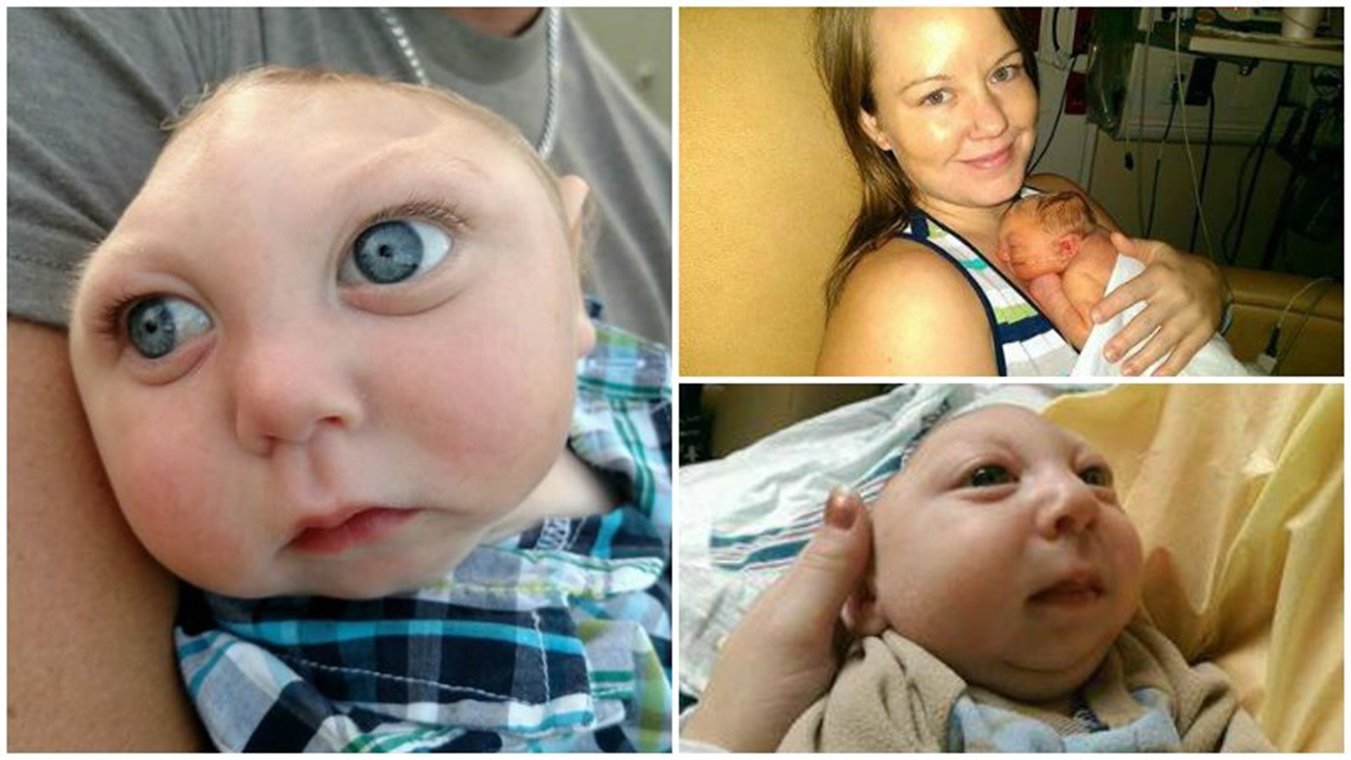 Baby born with part of skull missing defies the odds, celebrates first ...