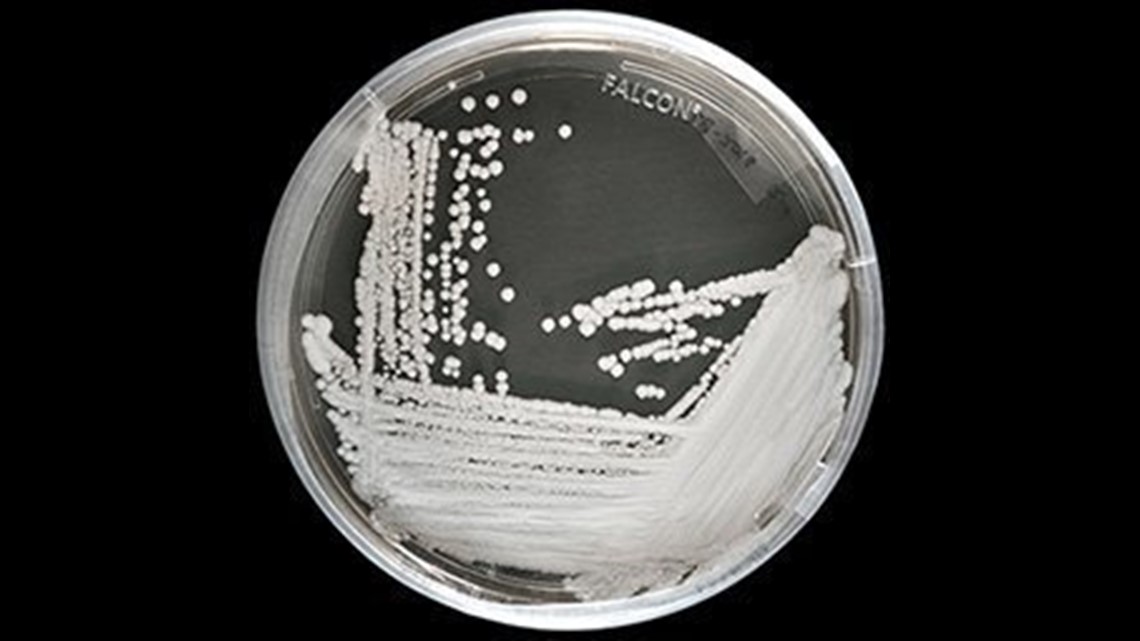 Superbug C. auris grows to 122 cases across 7 states, CDC says | fox43.com