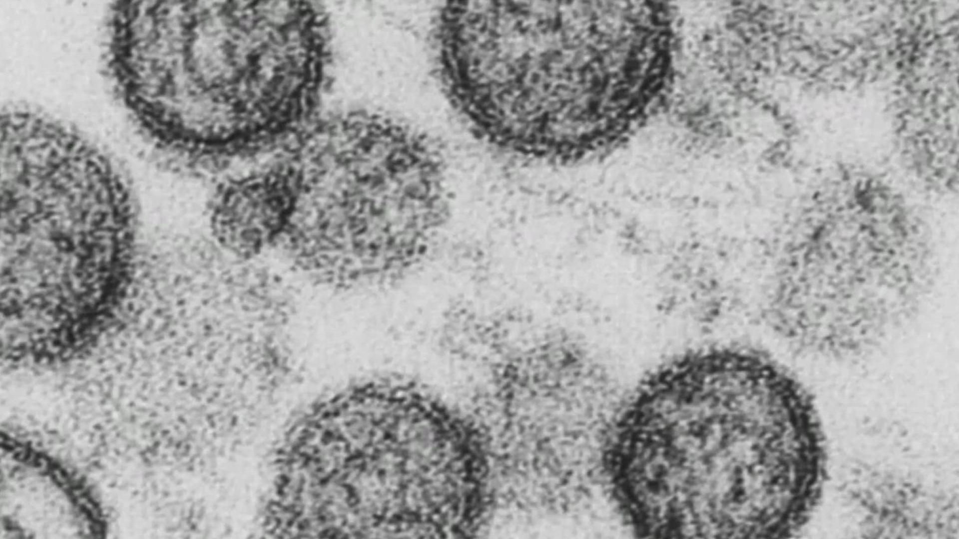 Pennsylvania Department of Health warns of measles spike in Lebanon ...