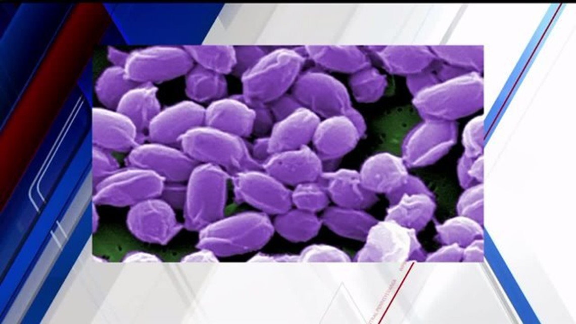 U.S. military ships live anthrax samples | fox43.com