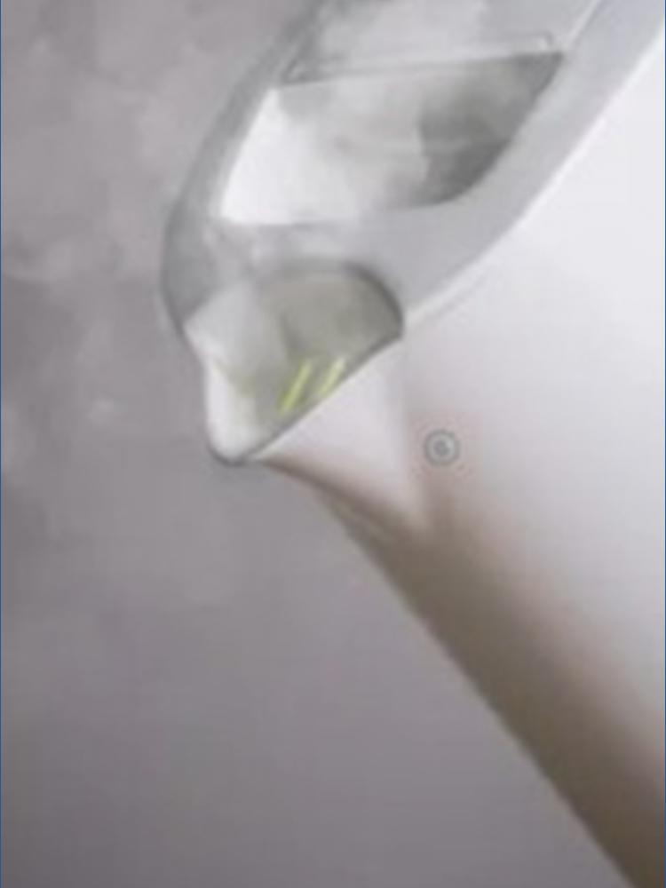 Police warn parents after 'Hot Water Challenge' prank severely burns ...