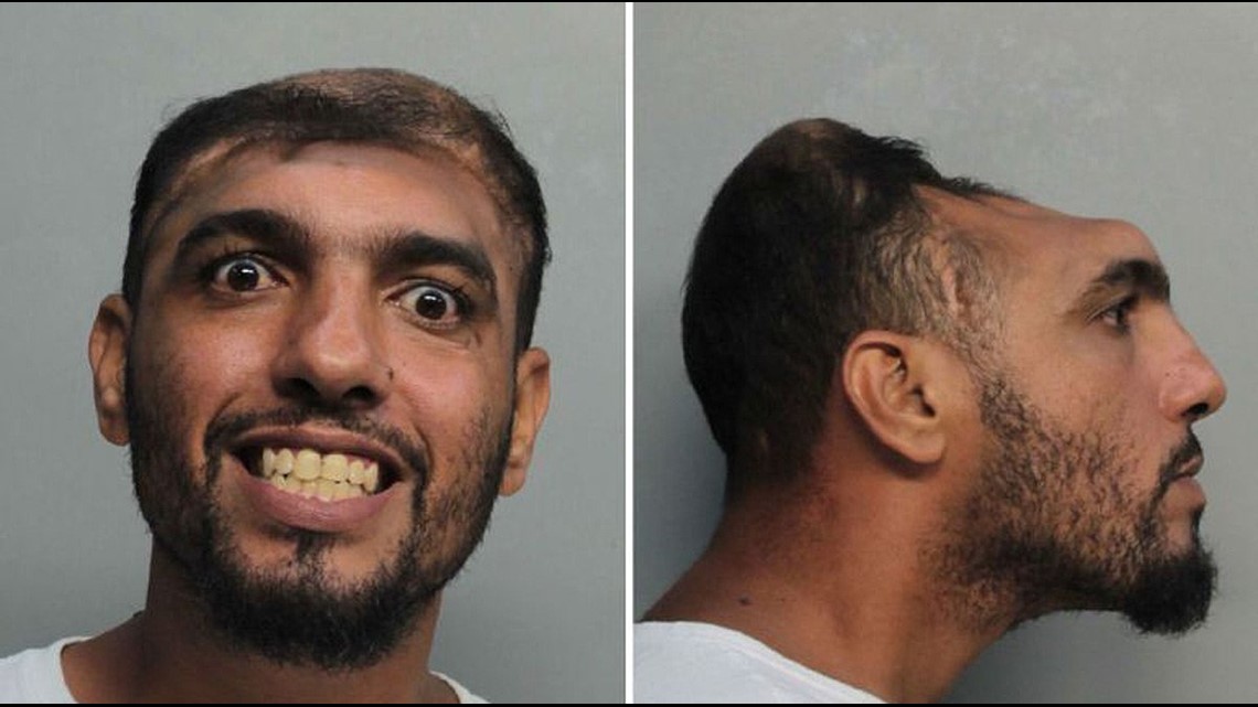 Man’s mug shot goes viral after arrest for arson, attempted murder ...