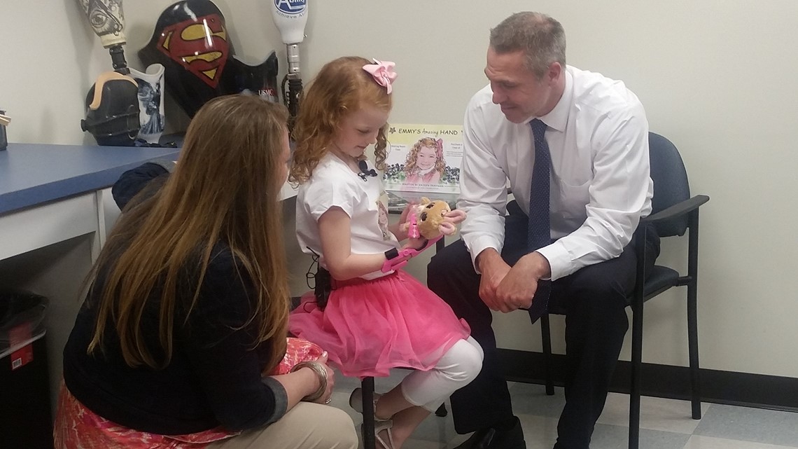 5-year-old born without fingers gets 3-D printed hand from ...