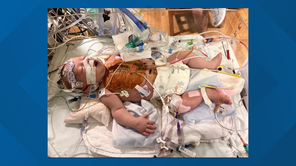 A death sentence turned miracle birth: 1-year-old boy survives rare ...