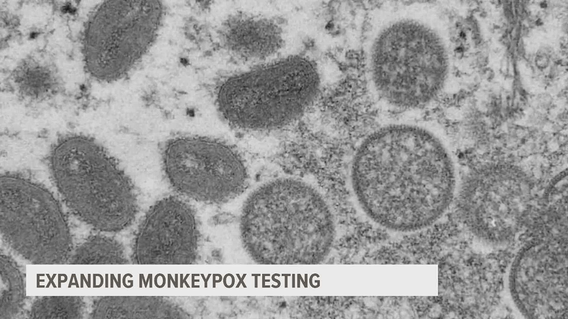US health officials expand monkeypox testing as cases rise | fox43.com