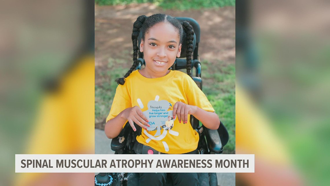 Life-saving drugs for spinal muscular atrophy patients | Health Smart ...