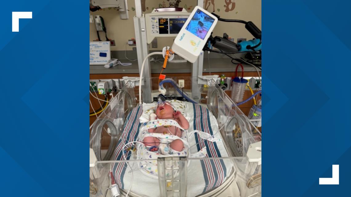 New NicView system helps families stay close to babies in NICU at UPMC ...