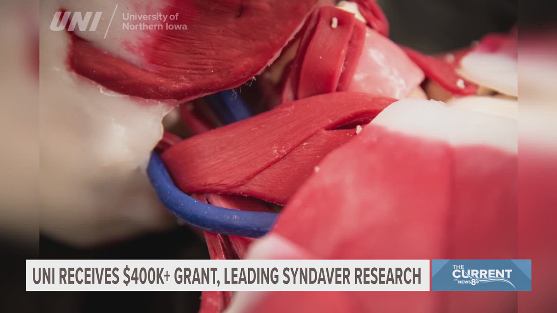UNI receives $412K grant to expand anatomy labs with life-like ...