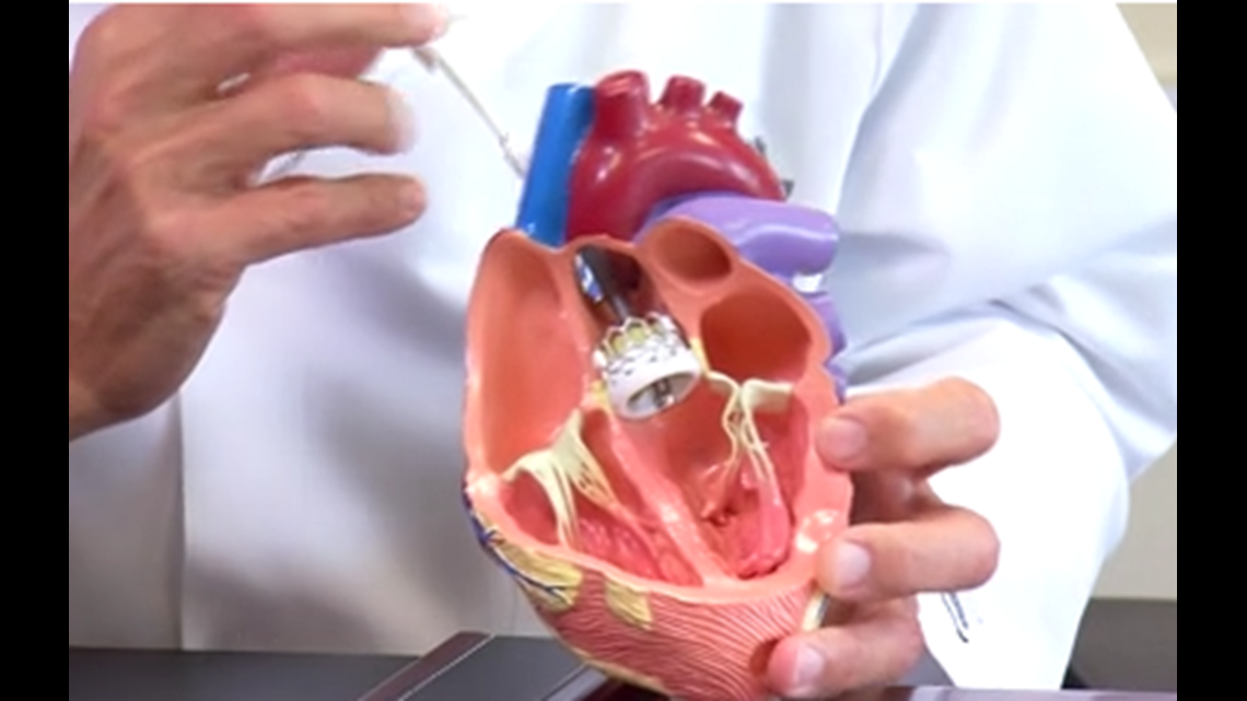 Take Trinity Heart Center's free 7-minute health assessment | wqad.com