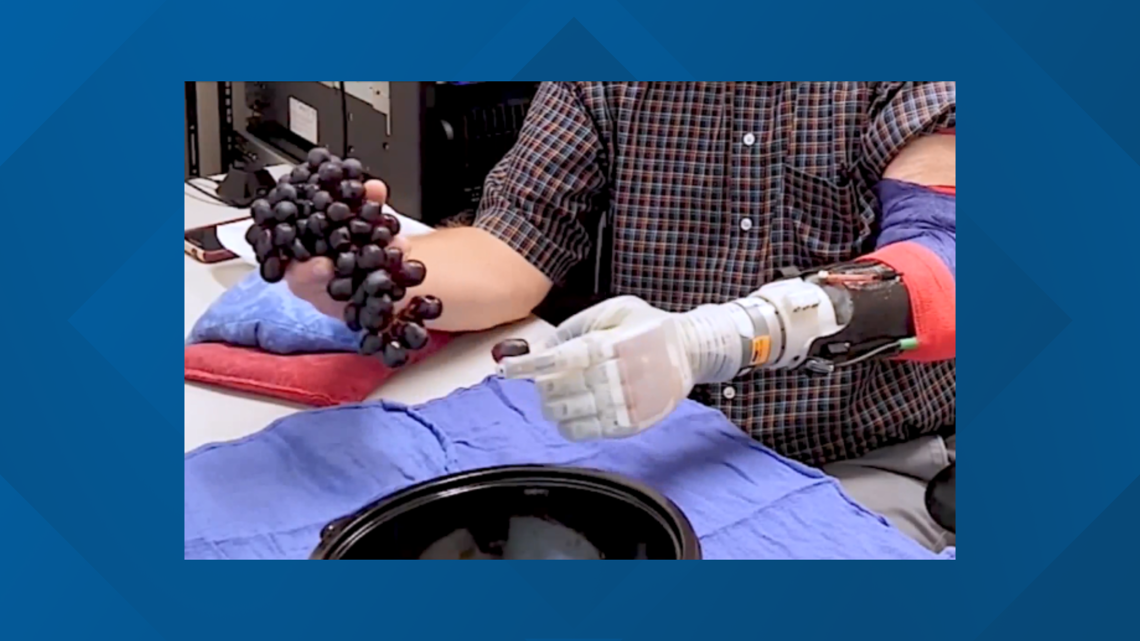 Amputee can feel objects again with prosthetic arm inspired by Luke ...