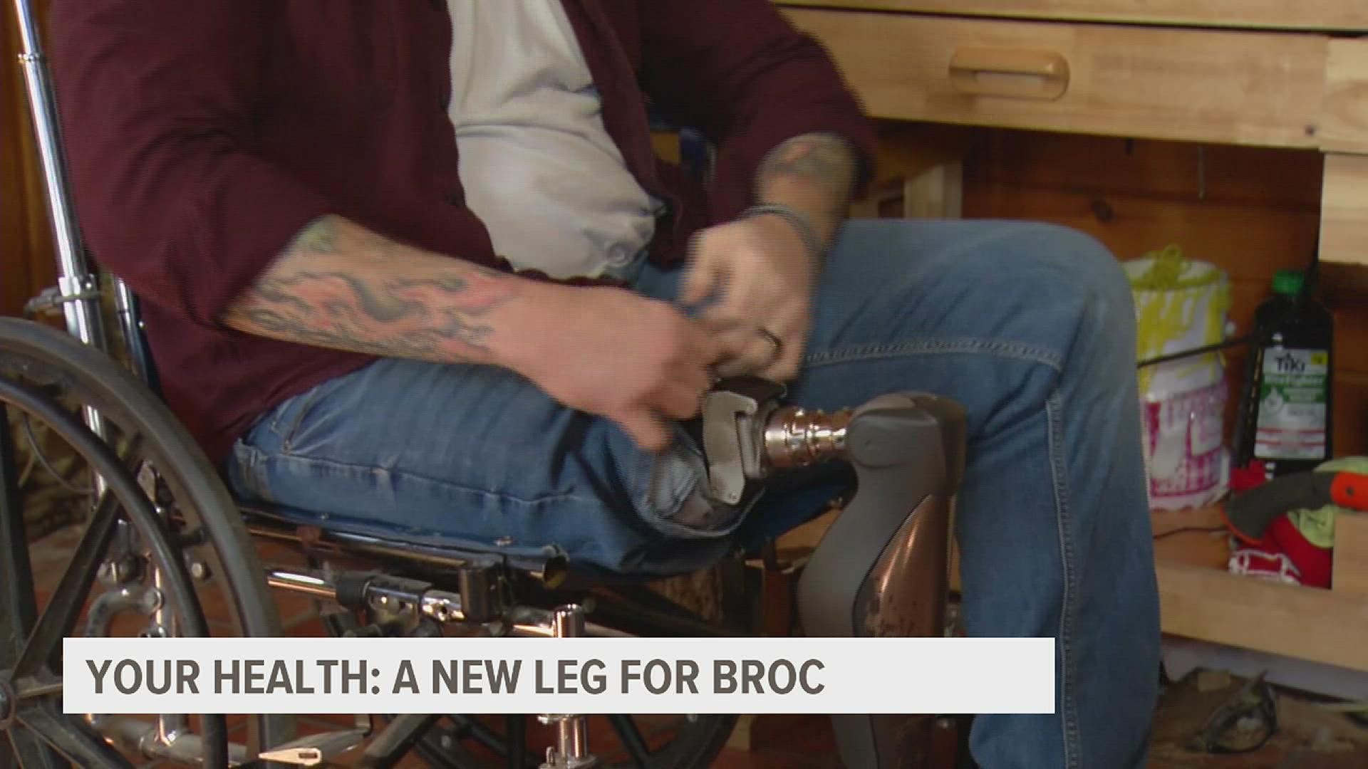 Your Health: A game-changer for amputees | wqad.com