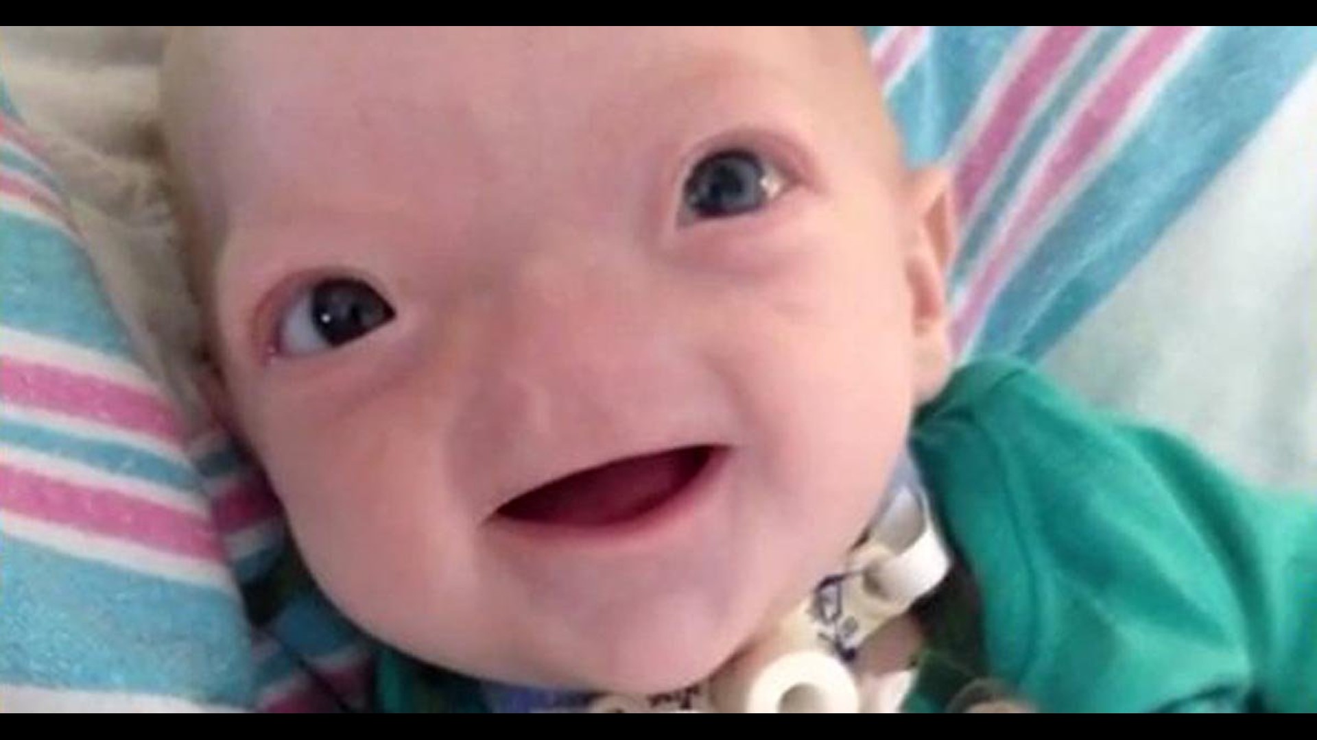 Eli, the ‘Miracle Baby’ born without a nose, has died | wqad.com