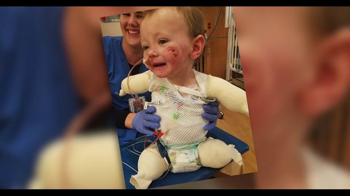 2-year-old recovering after quadruple amputation from illness | wqad.com