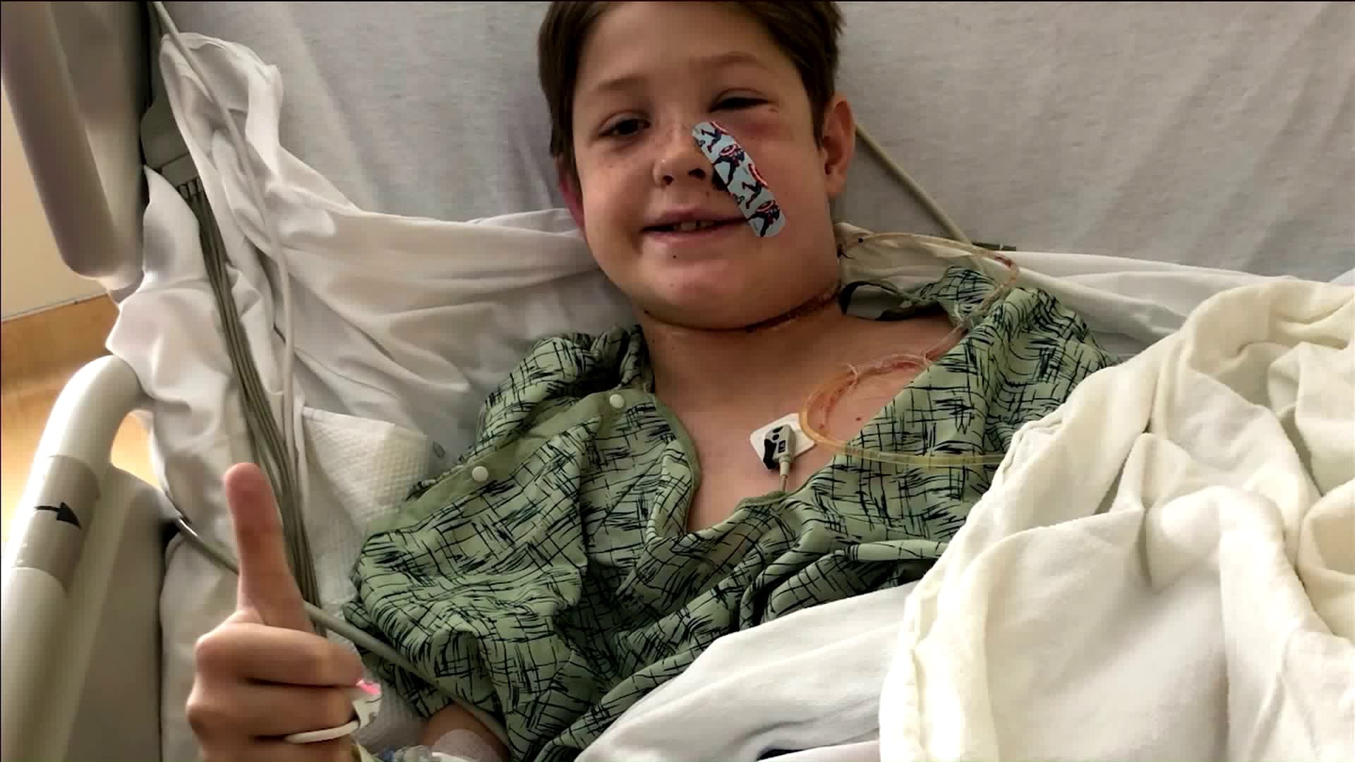 10-year-old survives after falling face first onto meat skewer | wqad.com