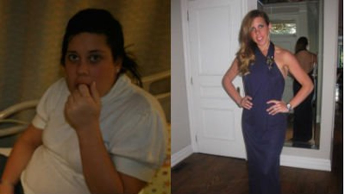 Mother Of Three Loses More Than 100 Pounds Gained During Pregnancy