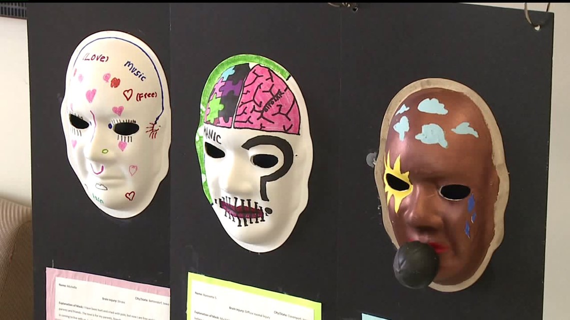 ‘Unmasking brain injury’ display gives insight into patients’ journey ...