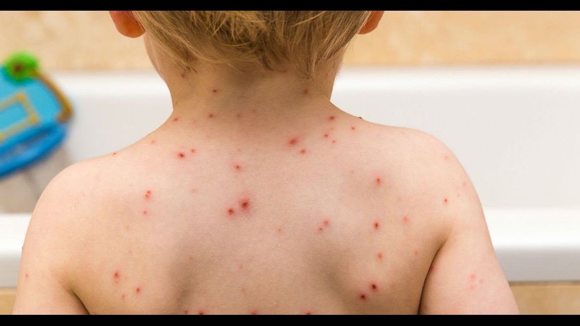School with high rate of vaccine exemptions faces state’s biggest ...