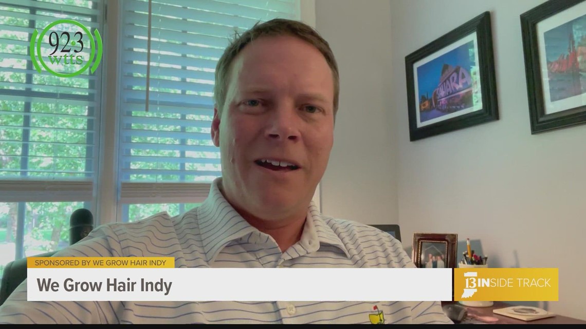 Learn about a local radio personality's hair restoration | wthr.com