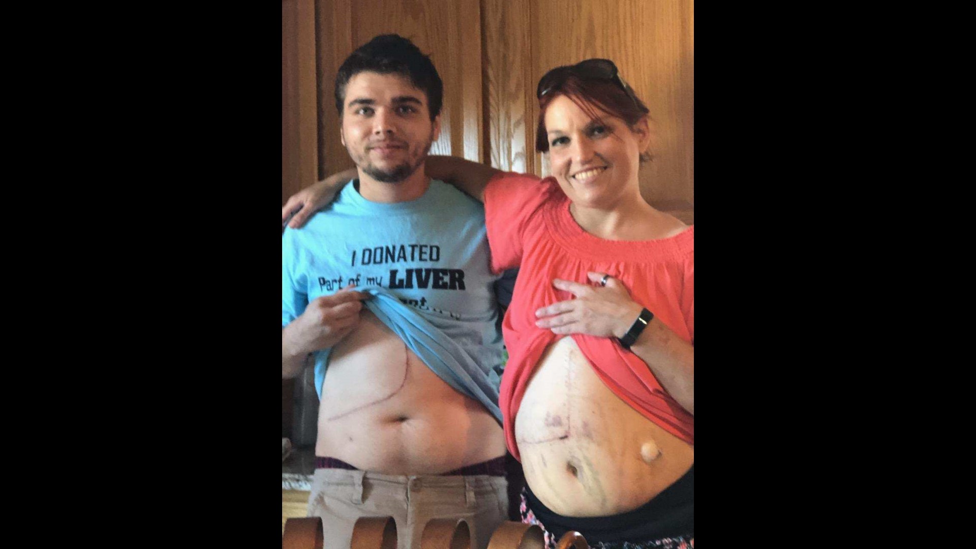 IU Health marks milestone with living donor liver transplant | wthr.com