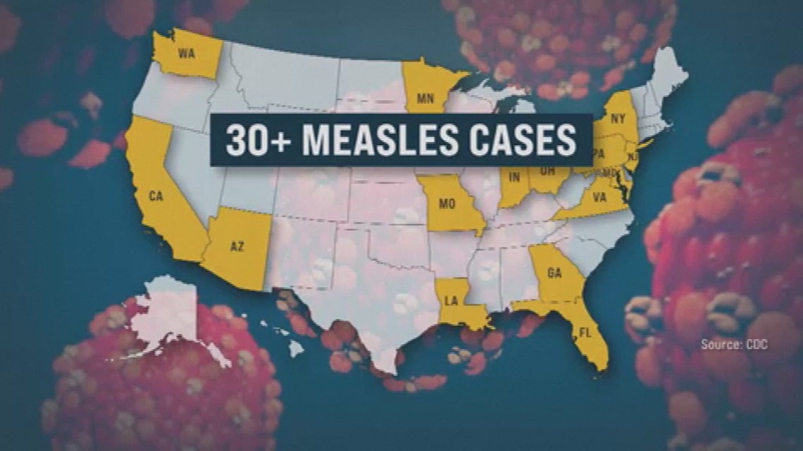 Cases of measles on the rise nationwide | wthr.com