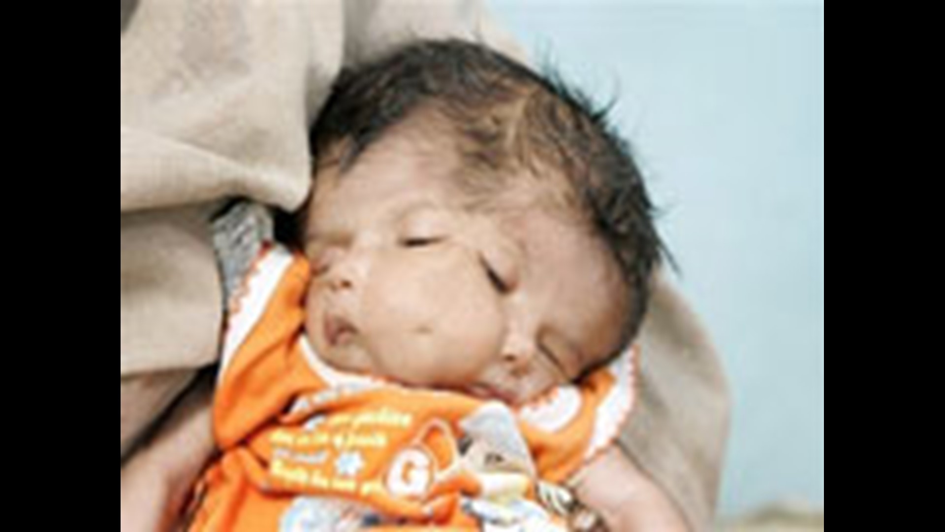 Baby with 2 faces born in north India | wthr.com