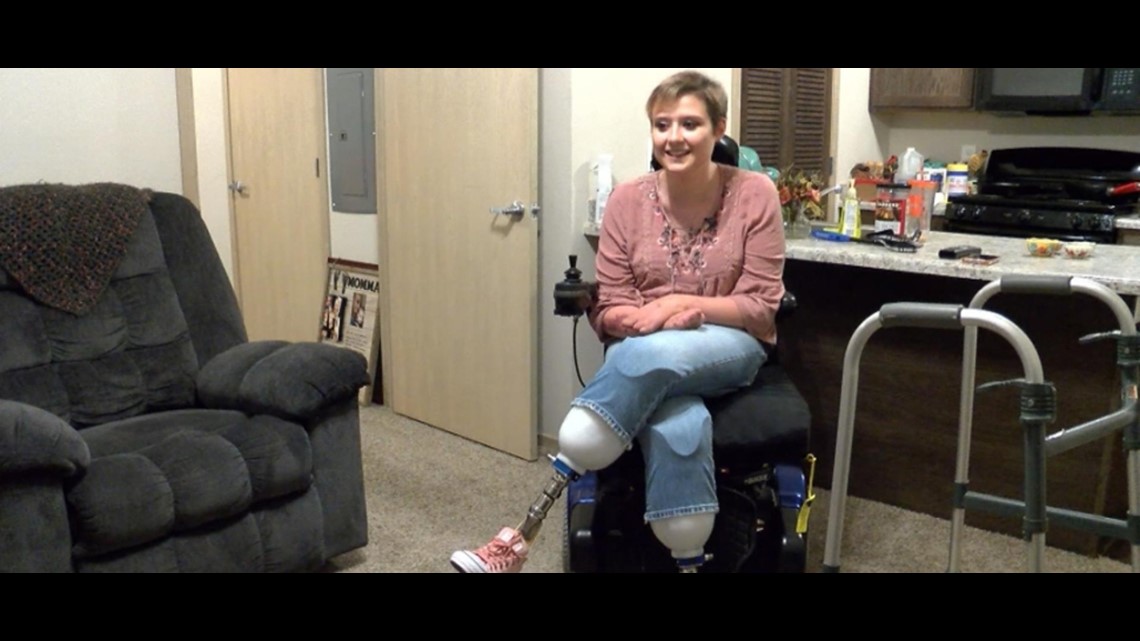 Kansas woman 'thriving' after losing legs in surgery complications ...