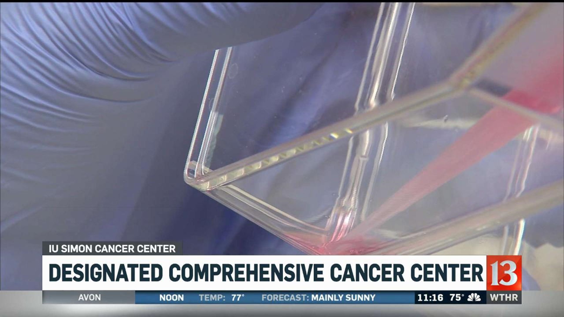 Simon Cancer Center recognized among best in country, gets $13.8 ...