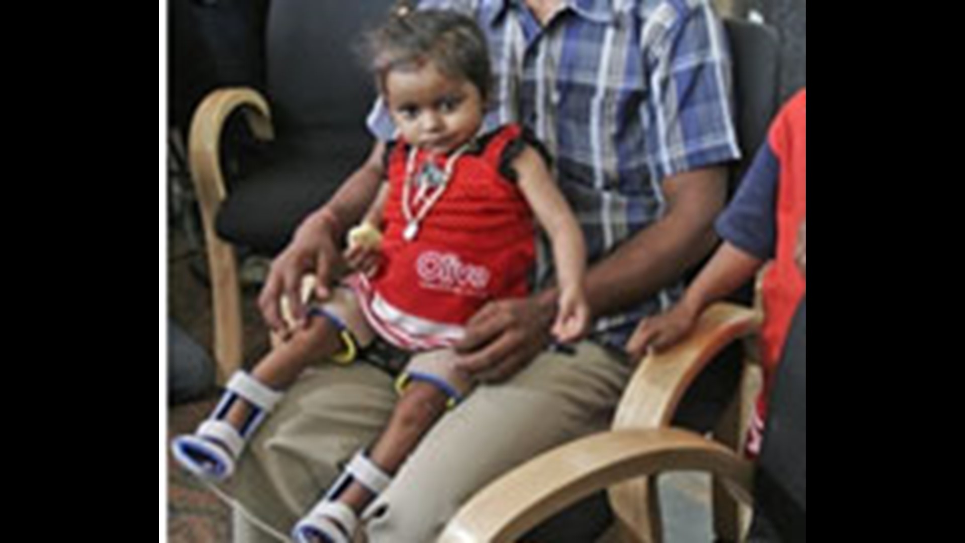 Girl born with 8 limbs leaves hospital | wthr.com