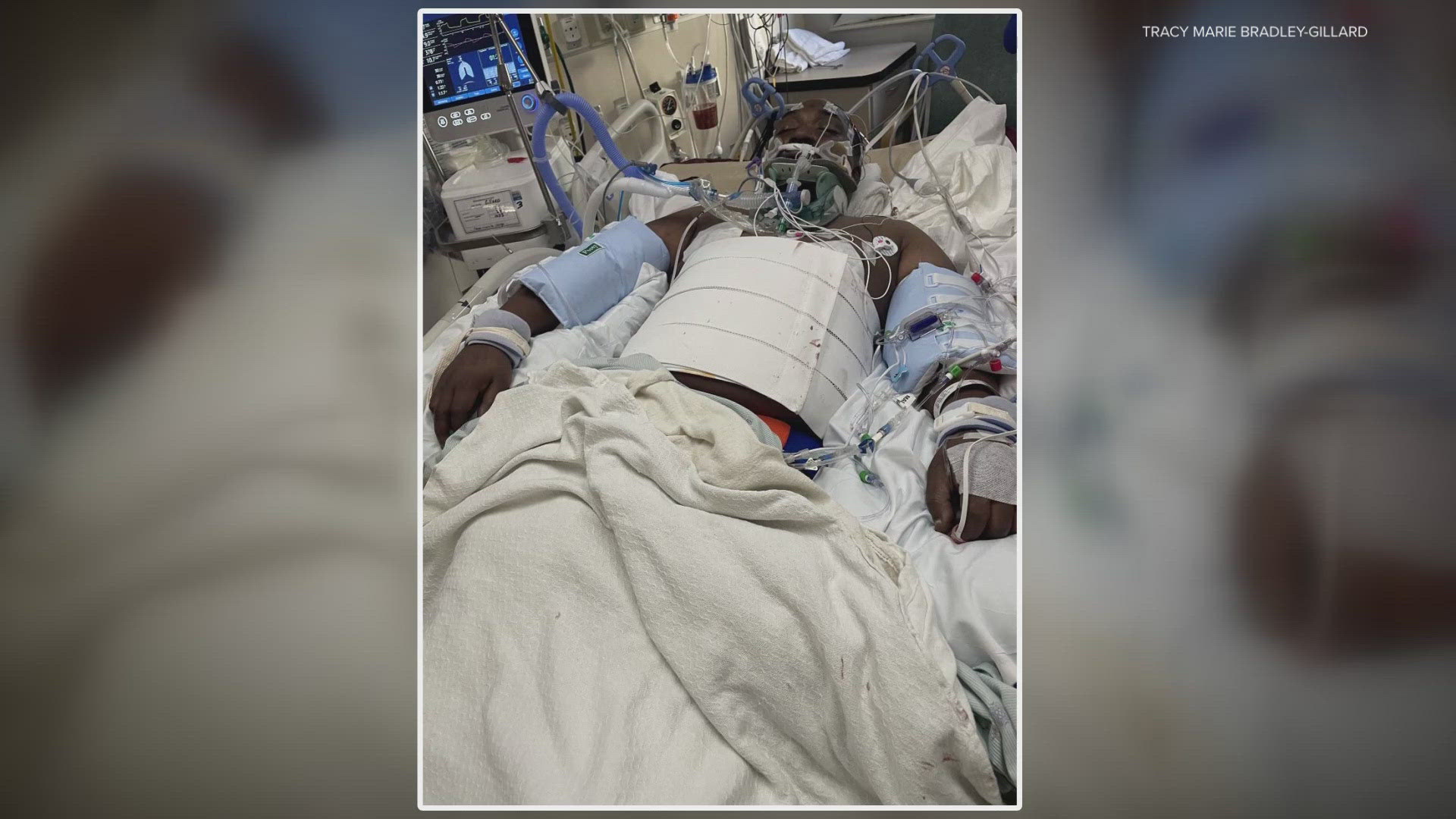 Indy man hit by car not expected to survive as family pushes for safer ...