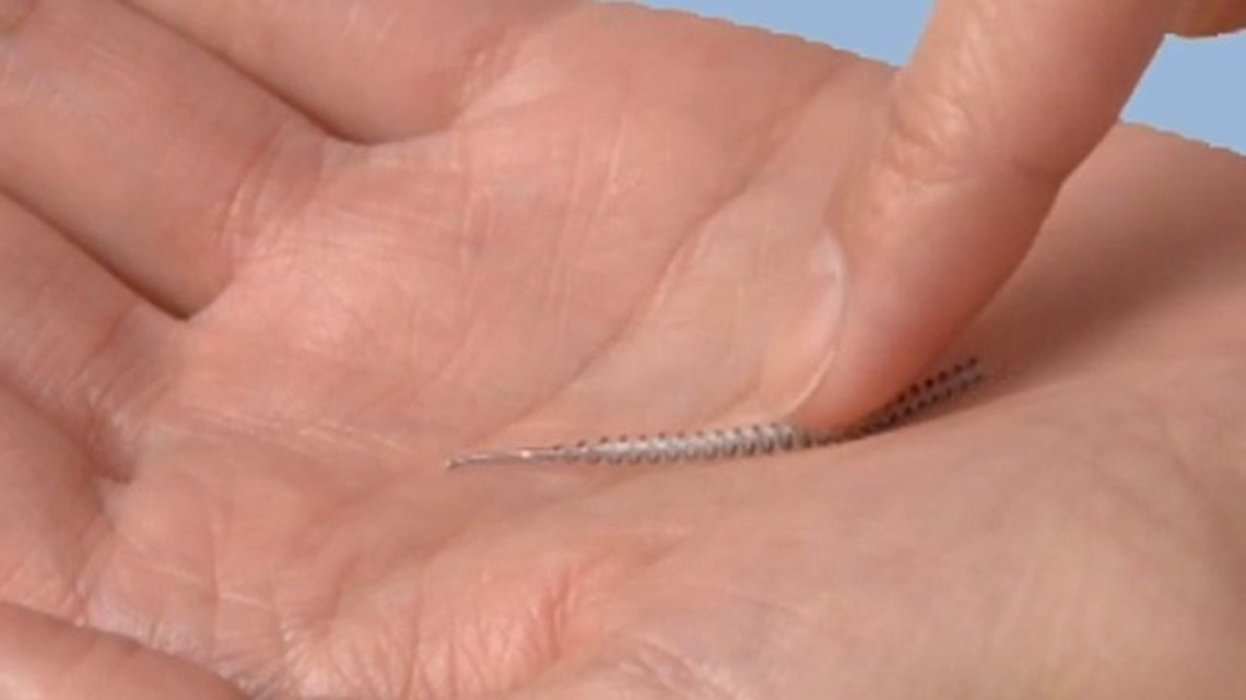 FDA demands new study for problematic birth control implant Essure ...