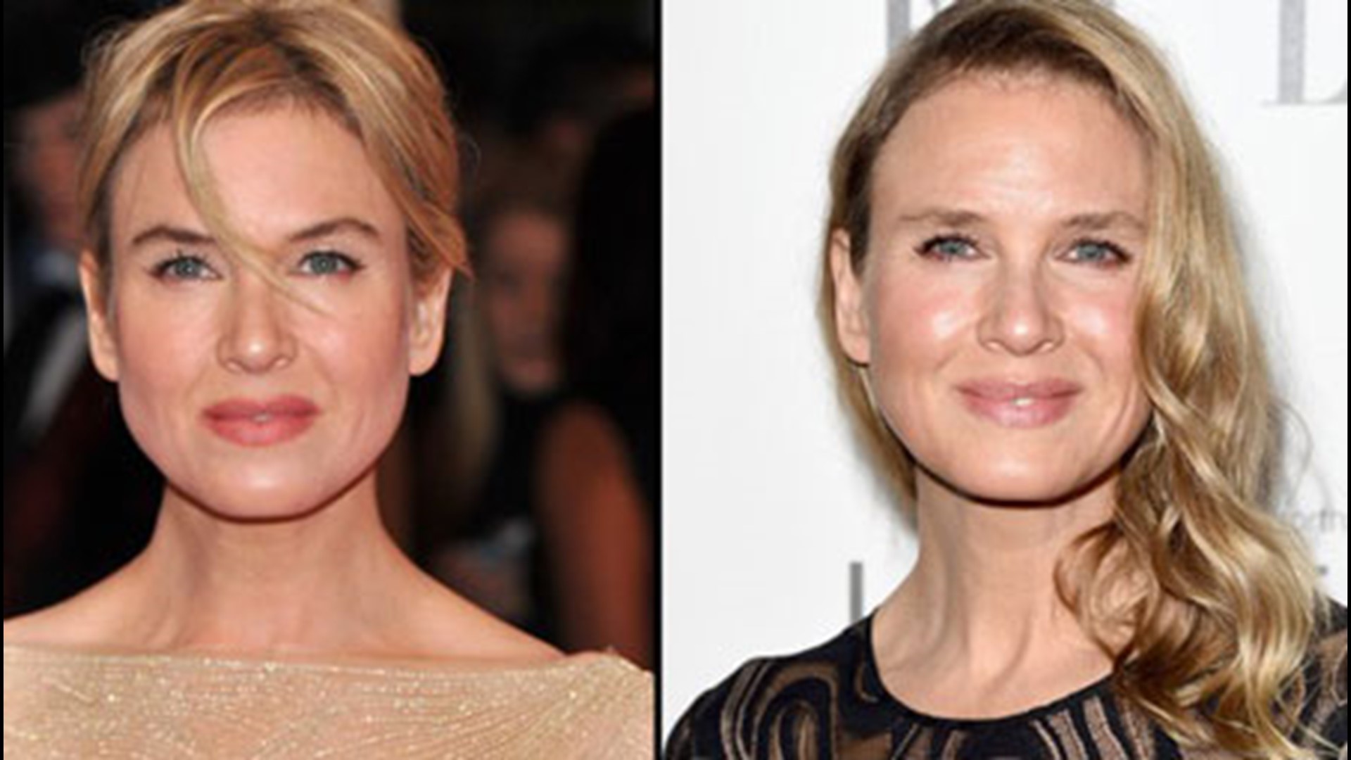 Renee Zellweger opens up about her new look | wthr.com