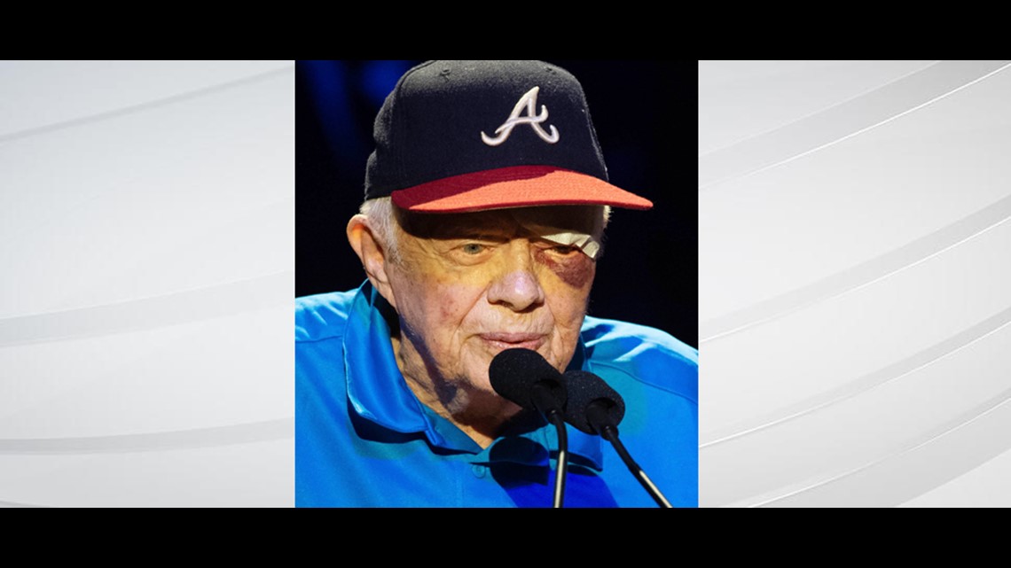 Ex-President Jimmy Carter has black eye, stitches after fall | wthr.com