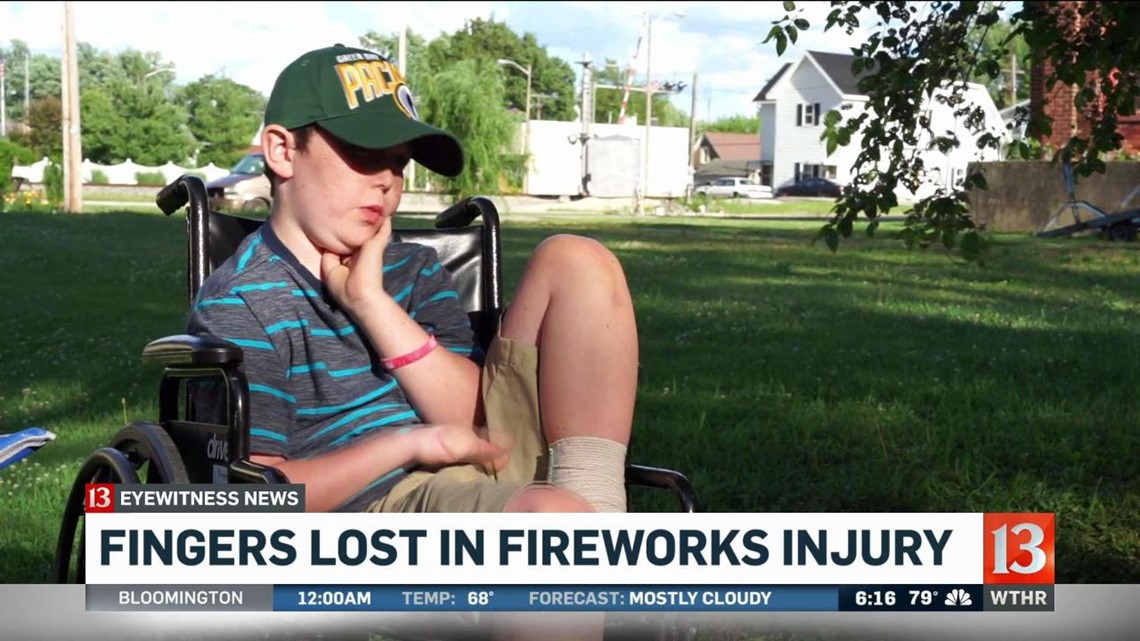 A Dangerous Lesson: Boy loses fingers in fireworks injury | wthr.com