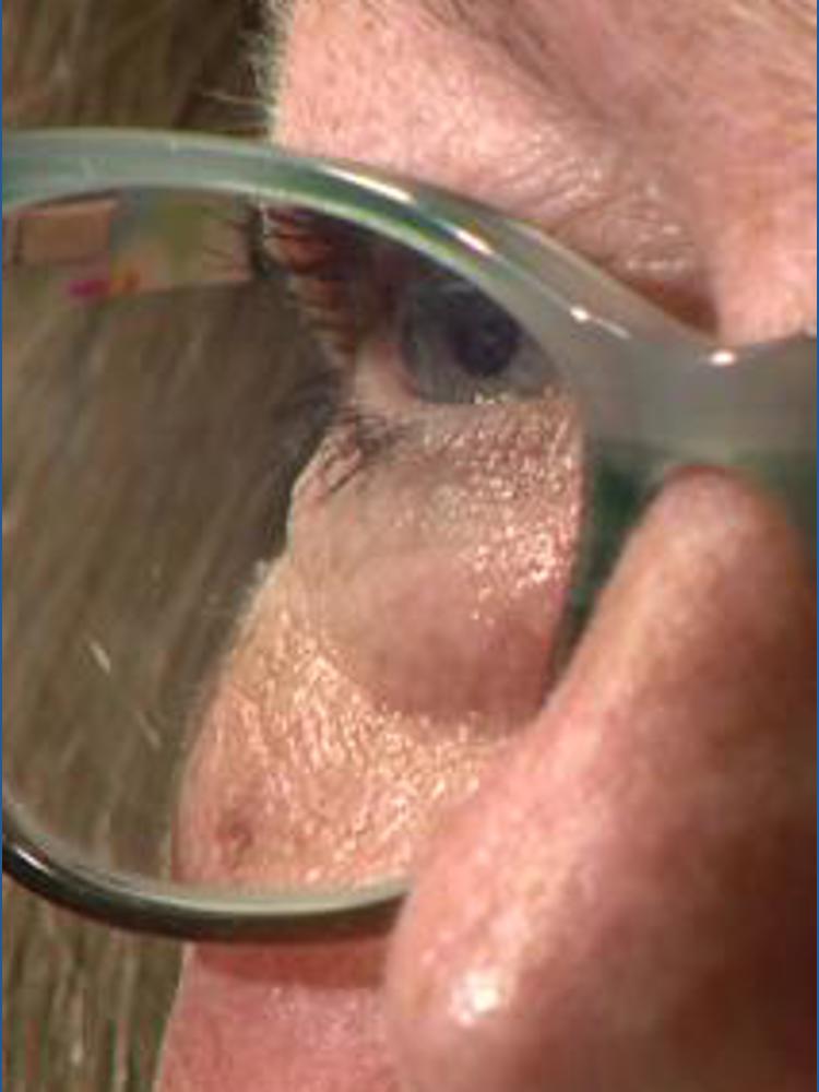 Indiana woman reports vision loss after taking GLP-1 drug; scientific ...