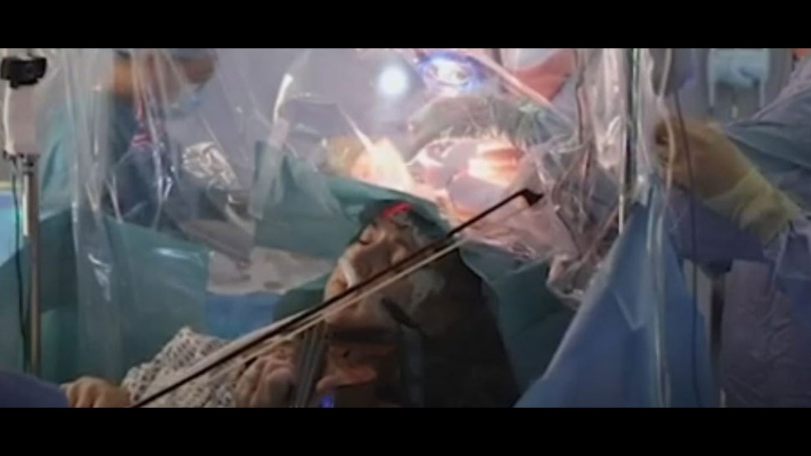 UK patient plays violin during unusual brain surgery | wthr.com