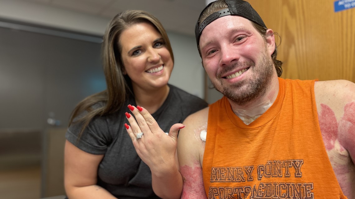 Burn survivor proposes to girlfriend at Ascension St. Vincent | wthr.com