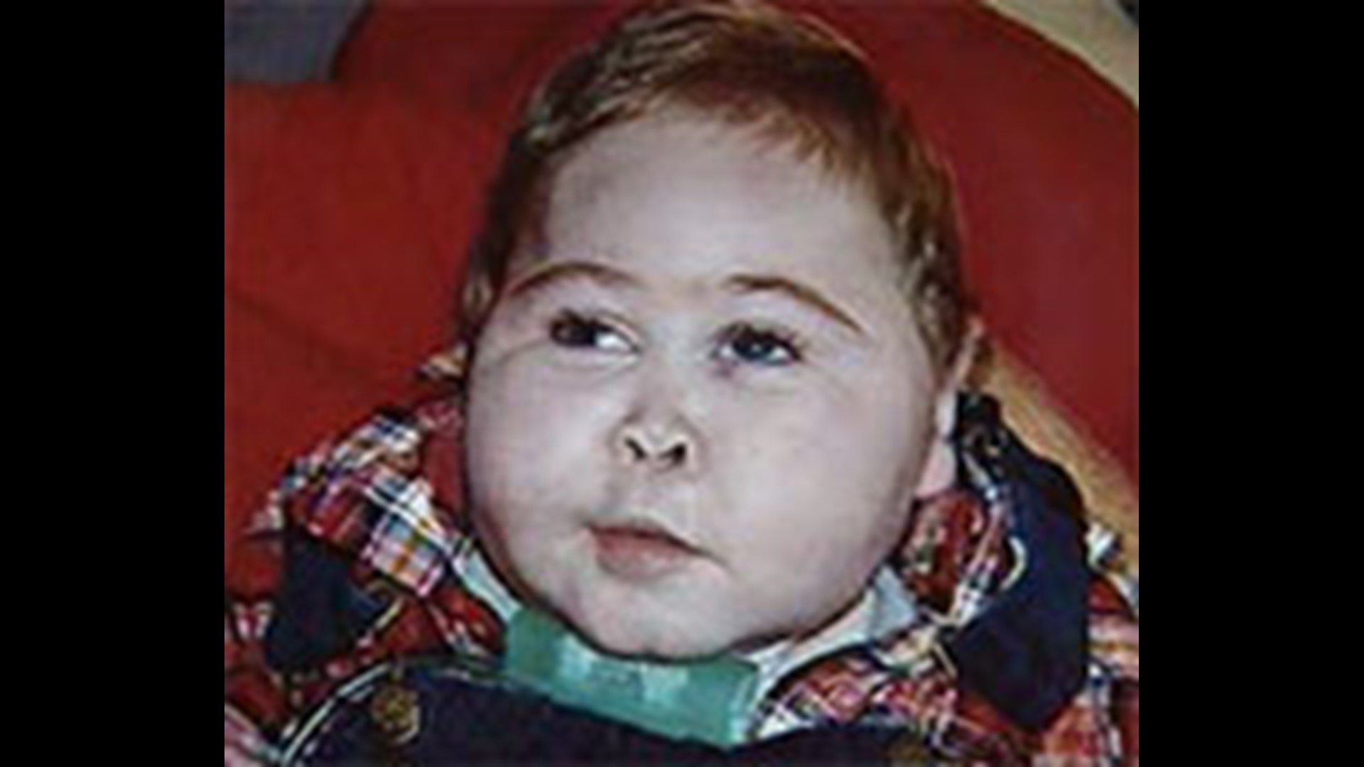 Young boy born with brain deformity touched many | wthr.com