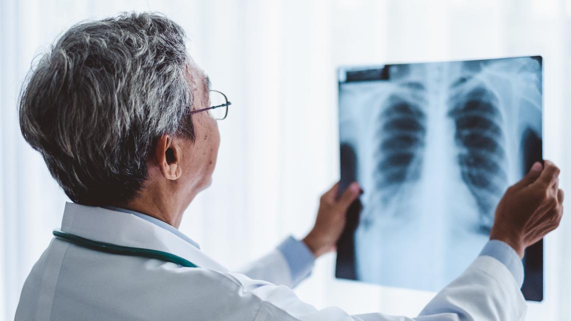 Living with COPD | Real Men Wear Gowns | wthr.com